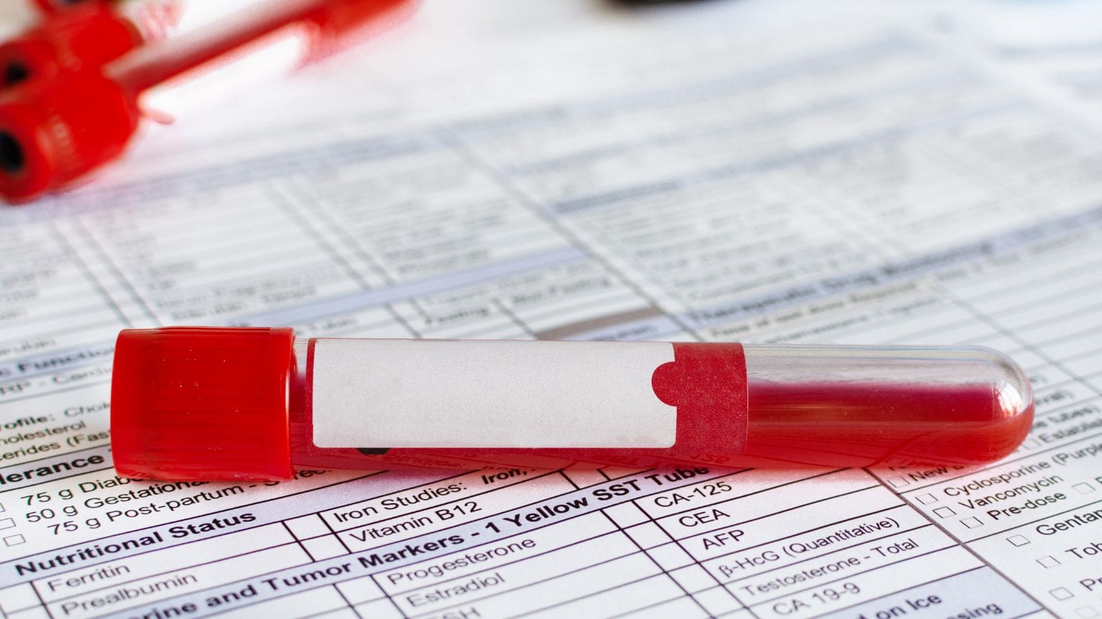 Lab-Grown Blood Given to People - Our News