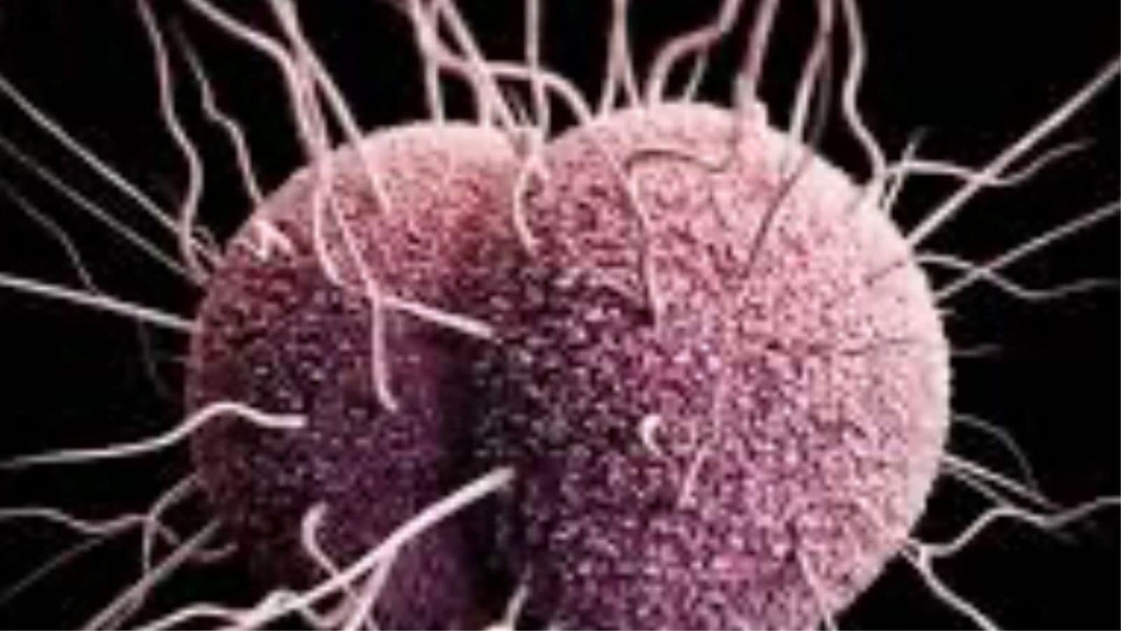 STI's Are Destroying Lives - Our News